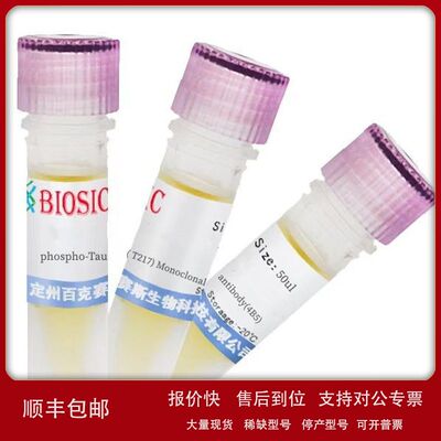 实验用单克隆抗体phospho-Tau (T217) Monoclonal antibody(4B5)