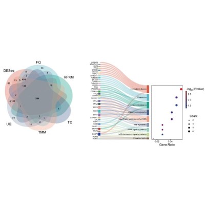 免疫细胞浸润生信数据挖掘个性化分析