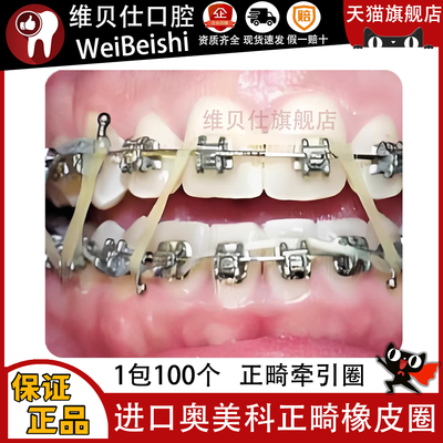 美国Ormco奥美科正畸橡皮圈皮筋橡皮圈牙齿矫正牵引皮筋牙套皮圈