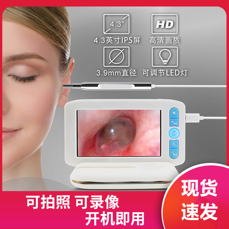 可视耳鼻喉内窥镜外科耳内镜电检耳镜宠物可视采耳高清耳镜挖耳勺
