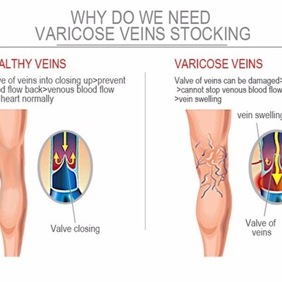 Varicose Ve Compression Socks Fit For Golf Rugby Hiking Spor