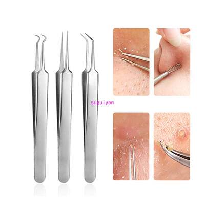 Quality Stainless Steel Blackhead Extractor Blackhead Remove