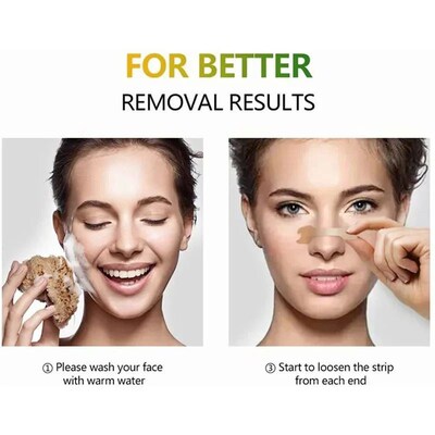 20/50/100pcs Breathing Nasal Strips Right Way Stop Snoring A