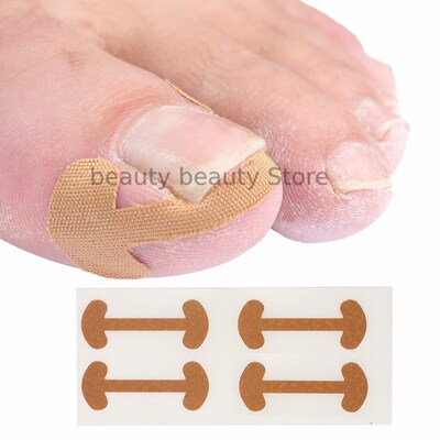 28/10pcs Ingrown Toenail Corrector Sticker Self-adhesive Par