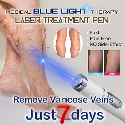 Blue ht Therapy Varcose Ven Pen Medcal Varcose Scar Ven Pen
