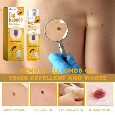 Revitalize Your Skin With Ximonth Bee Venom Spray For Wart