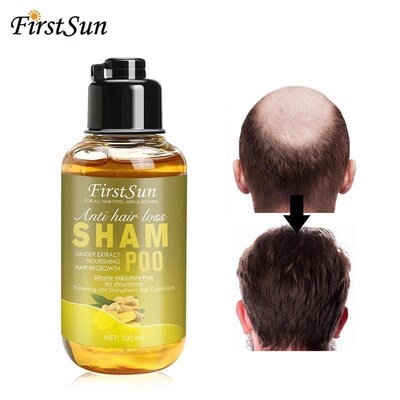 100ml ginger shampoo Anti-hair loss repair dry hair Gentle d