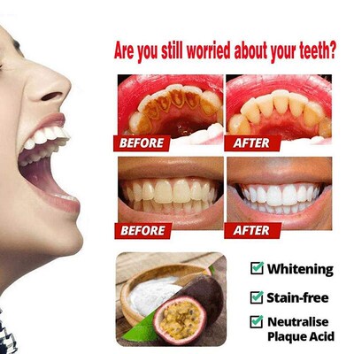 Teeth Whitening Soda Toothpaste Cleaning Stain Removal Fight