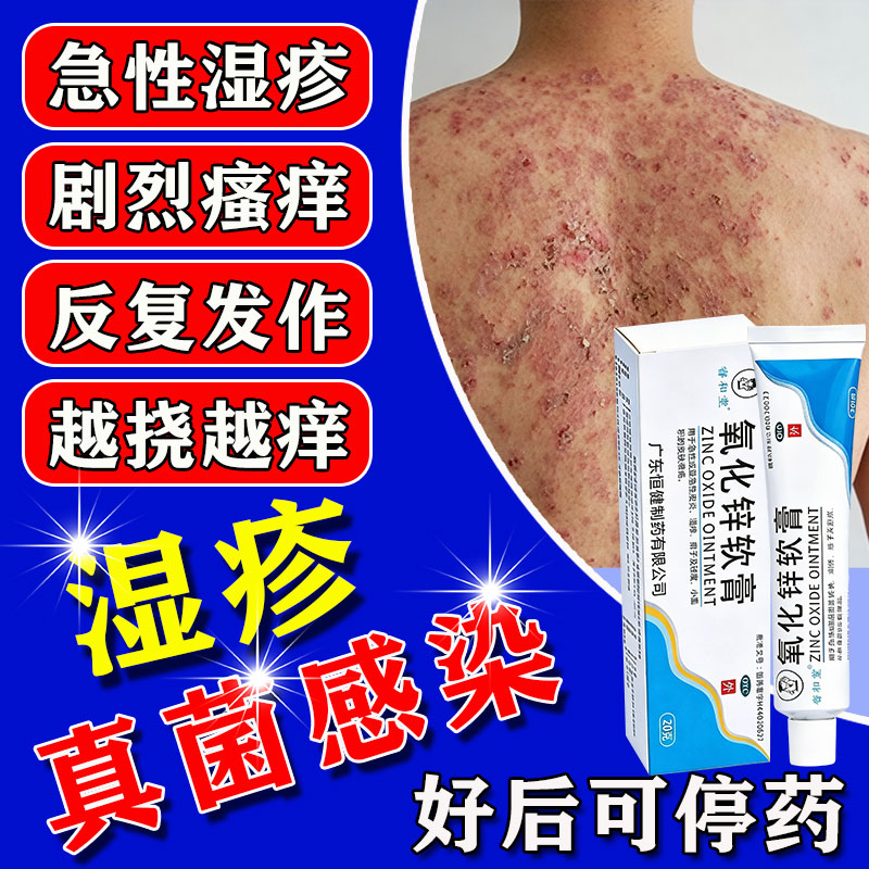 氧化锌油软膏正品官方旗舰店医用级湿疹特止痒效药皮肤瘙痒湿疹C