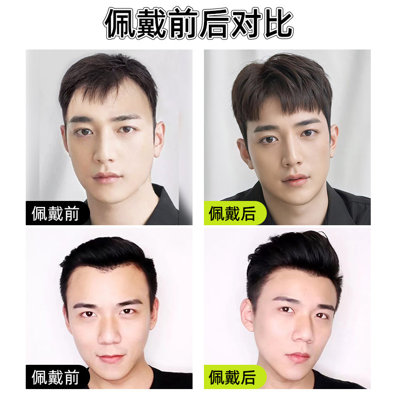 发际线假发贴男士前额轻薄m型生物头皮无痕隐形补发片真发刘海片