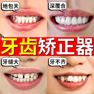 牙齿矫正牵引器非修复地包天