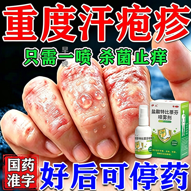 汗疱疹抑菌喷剂手上起小水泡专用药止痒真菌感染手足癣湿疹杀菌膏