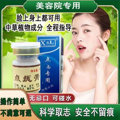 点痣膏斑痣无痕正品去凸痣红痣美容院专用脸部不留疤痦子黑痣神器