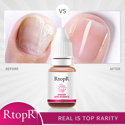 GingerNailEssenceRepair修复