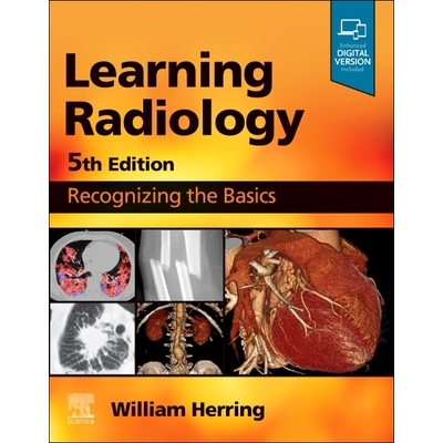 Learning Radiology Recognizing the Basics 学习放射学：认识基础知识 9780323878173