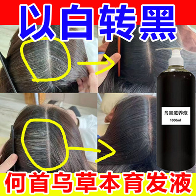 何首乌白转黑乌黑滋养液养发液侧柏叶皂防脱掉发增密精华素育发液