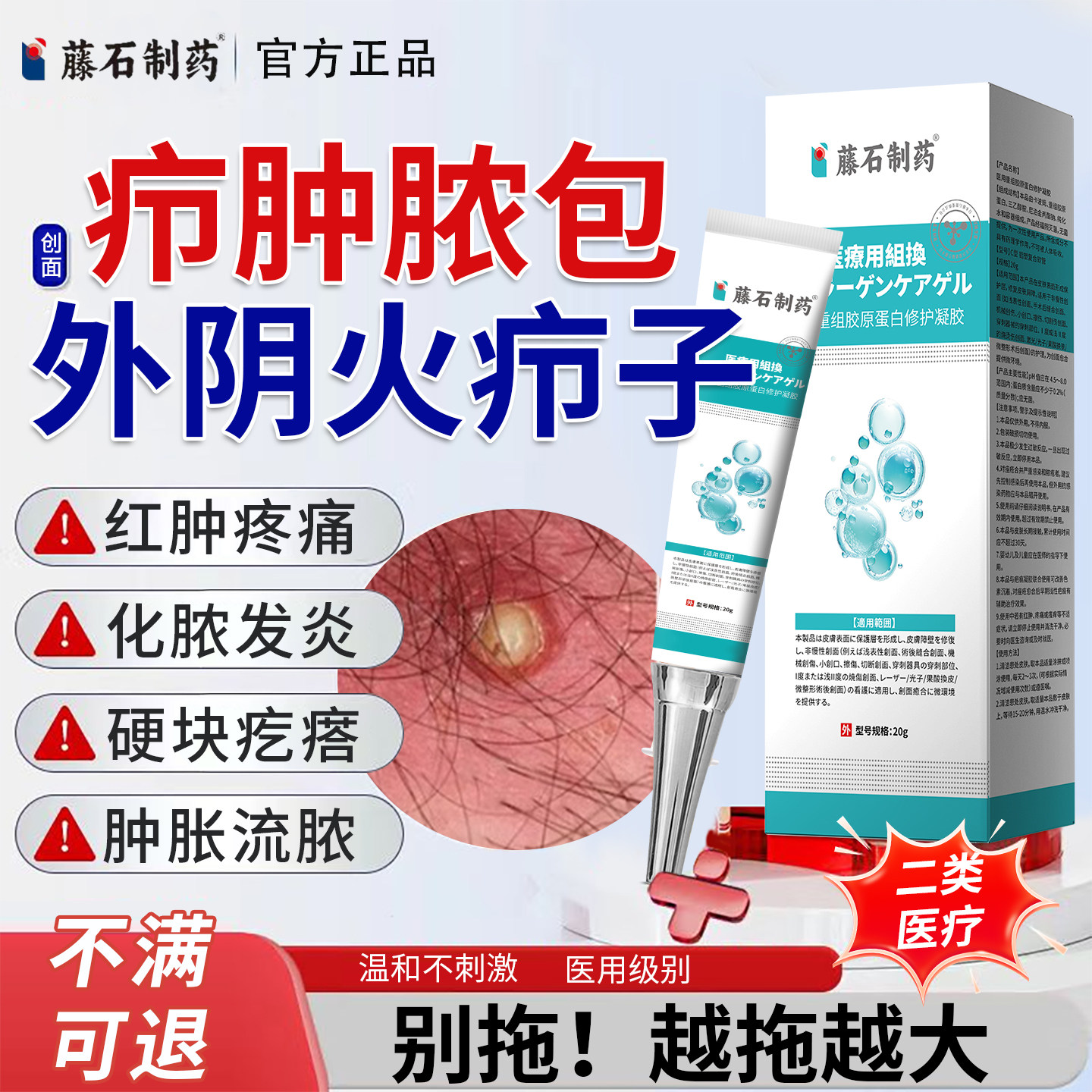 外阴火疖子拔毒拔脓膏脓包硬块私处疖肿皮脂腺囊肿敷料搭膏药贴YU
