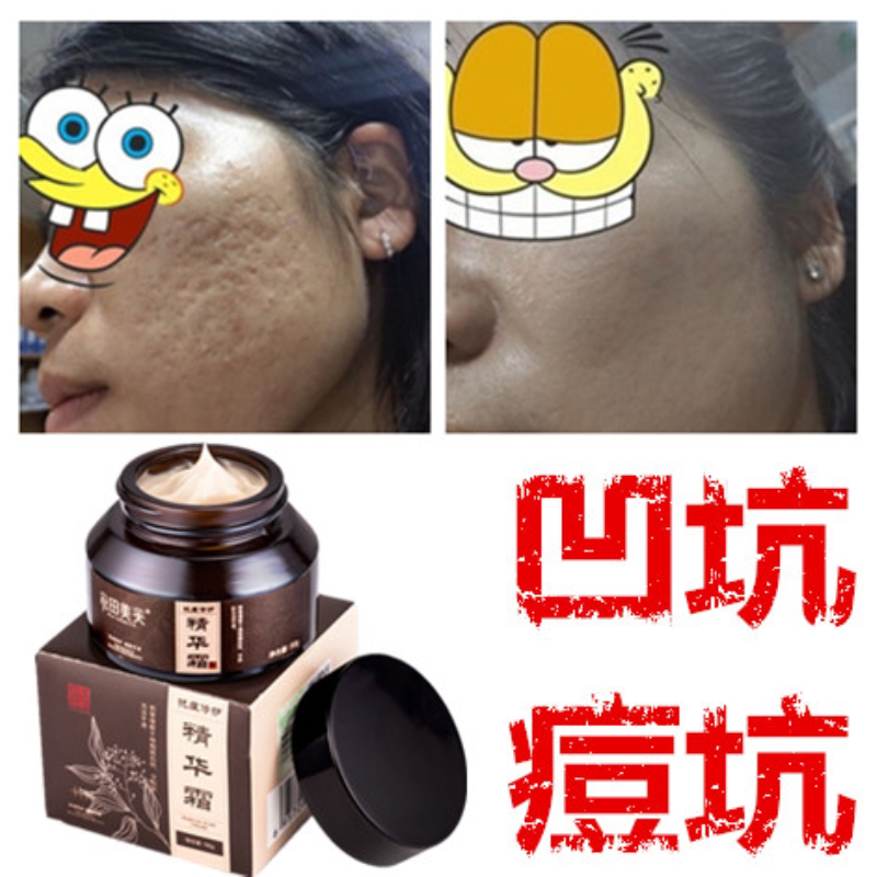 祛除抚平凹陷痘疤痕再生长修护膏消印抚痕霜填平凹洞痘坑痘印产品