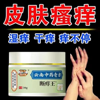 祖药铺云南中药奇脚方泡断痒王g栏丫脚医痒藓小水脚包BGT脱皮脚臭