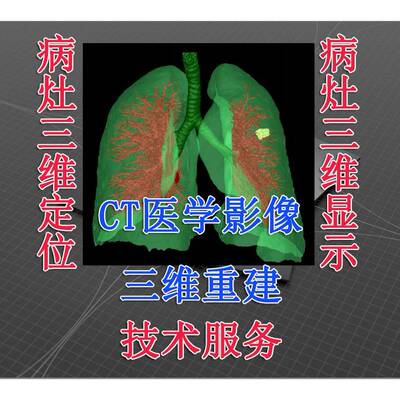 CT三维重建 DICOM文件 DCM文件 医学图像重建 CT影像重建制作服务