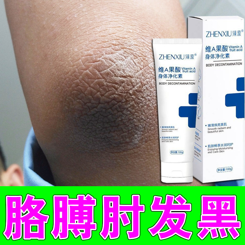维A果酸身体净化素改善腋下手肘膝盖脖子关节暗沉粗糙干燥鸡皮