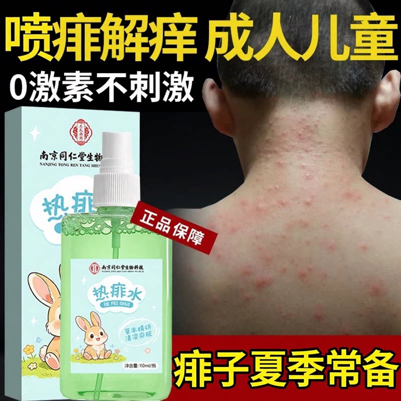 成人儿童痱子水去身上红疙瘩痱子痒全身适用防蚊虫叮咬热痱水喷雾