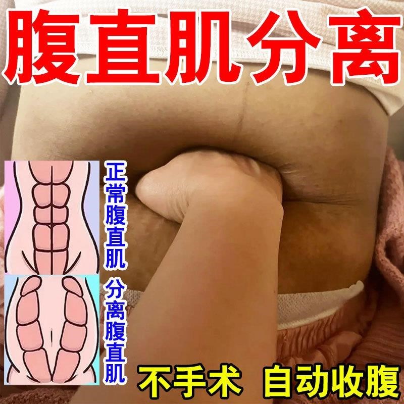 腹直肌分离修复仪产后家用贴矫正肚子松大小腹凸出假胯宽收胯神器