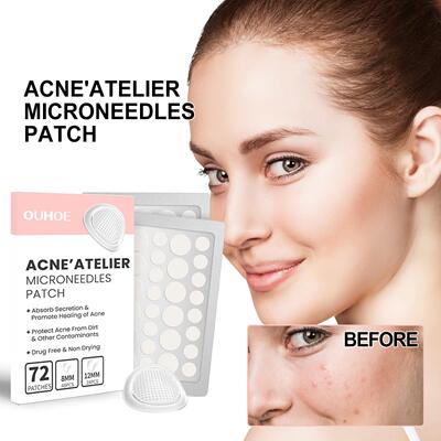 OUHOE Pimple Patch for Facial Redness Care, Acne, and Pore C