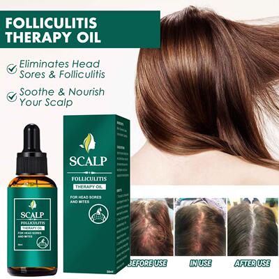 EELHOE Scalp Nourishing Hair Oil - Deep Cleansing and Repair
