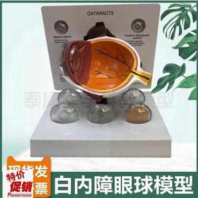白内障眼睛模型可拆卸眼科医生用晶状体病变眼R底视网膜神经血管