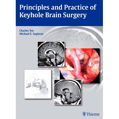 预订 Principles and Practice of Keyhole Brain Surgery 小孔脑手术的原理和实践: 9783131758514