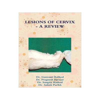 预订 Lesions of Cervix - A Review
