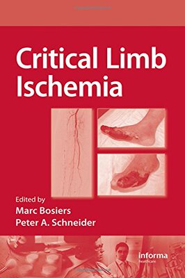 【预订】Critical Limb Ischemia