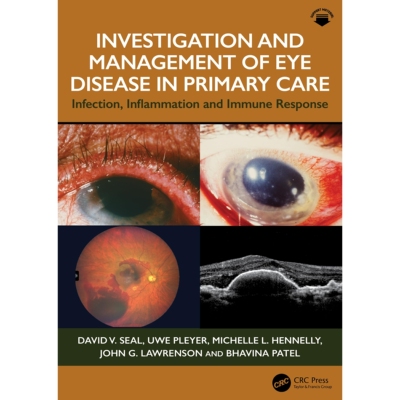 预订 Investigation & Management of Eye Disease in Primary Care Infection, Inflammation and Immune Response 初级保健的眼