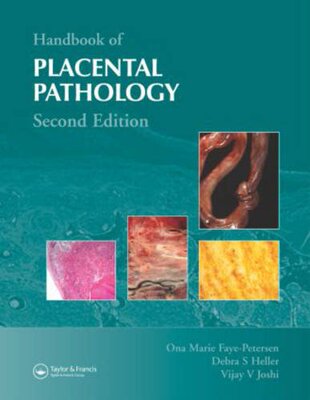 【预订】Handbook of Placental Pathology