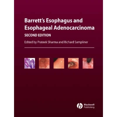 预订 Barrett’S Esophagus And Esophageal Adenocarcinoma 2E Barrett食管与食道腺癌: 9781405127868