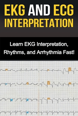 【预订】EKG and ECG Interpretation: Learn EKG Interpretation, Rhythms, and Arrhythmia Fast!