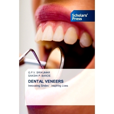 预订 Dental Veneers: 9786206773993
