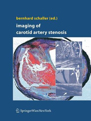 【预订】Imaging of Carotid Artery Stenosis