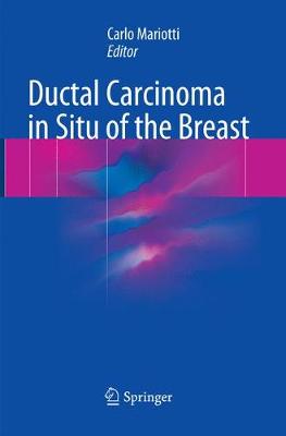 【预订】Ductal Carcinoma in Situ of the Breast
