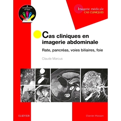 预订 Cas cliniques en imagerie abdominale : rate, pancréas, voies biliaires, foie 腹部影像学临床病例：脾脏、胰腺、胆管