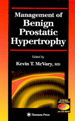 【预订】Management of Benign Prostatic Hypertrophy