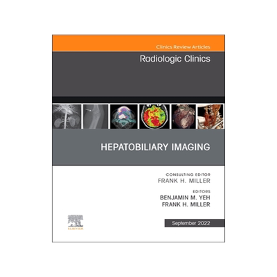[预订]Hepatobiliary Imaging, an Issue of Radiologic Clinics of North America