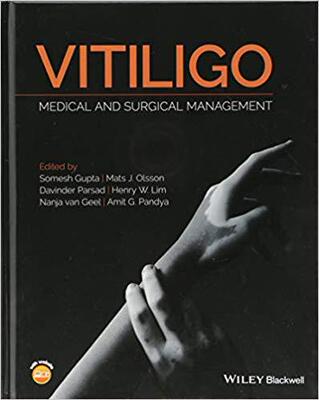 【预售】Vitiligo - Medical And Surgical Mana...