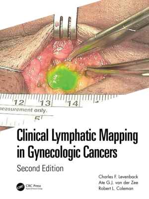 【预订】Clinical Lymphatic Mapping in Gynecologic Cancers 9781032186436