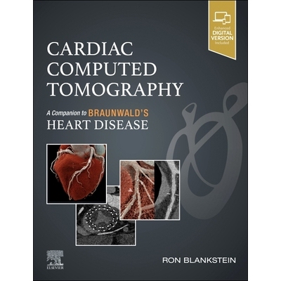 预订 Cardiac Computed Tomography A Companion to Braunwald’s Heart Disease 心脏计算机断层扫描：布劳瓦尔德心脏病的伴侣 97