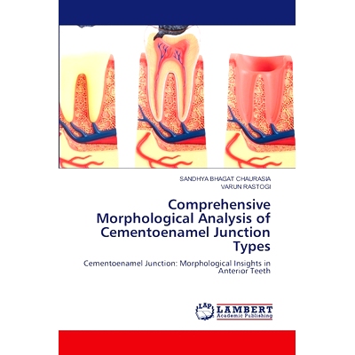 预订 Comprehensive Morphological Analysis of Cementoenamel Junction Types 牙釉质结型的综合形态学分析: 9786208065874