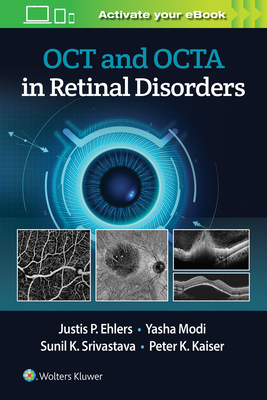 【预订】OCT and OCTA in Retinal Disorders