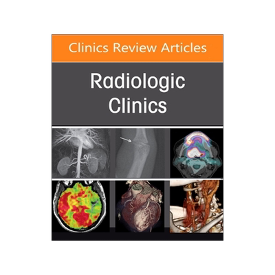 预订 Spine Imaging and Intervention, an Issue of Radiologic Clinics of North America