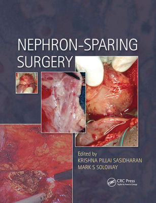【预订】Nephron-Sparing Surgery